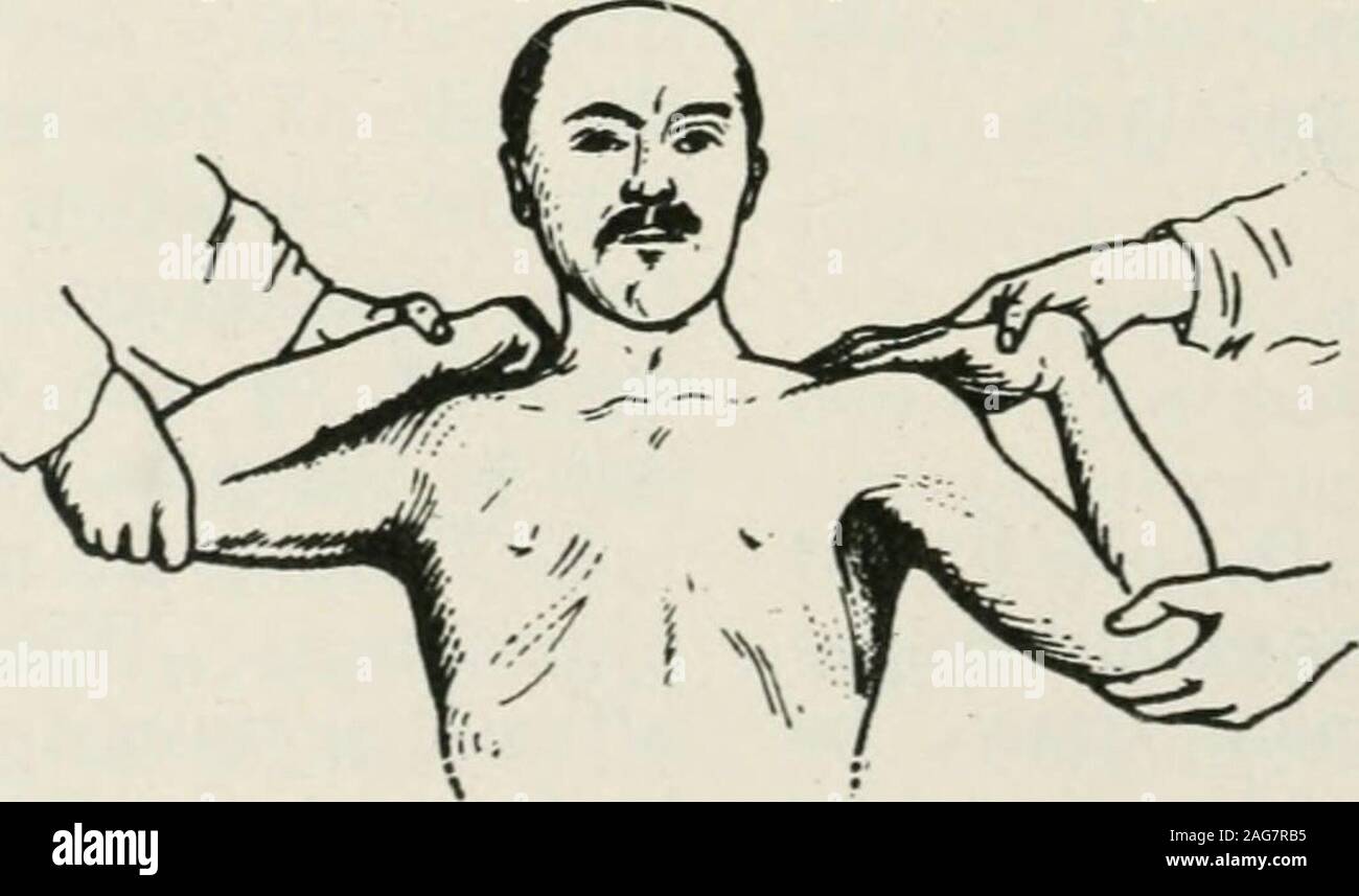 . Medical and surgical therapy. Fig. 17.—Extensor response (Babinski ...