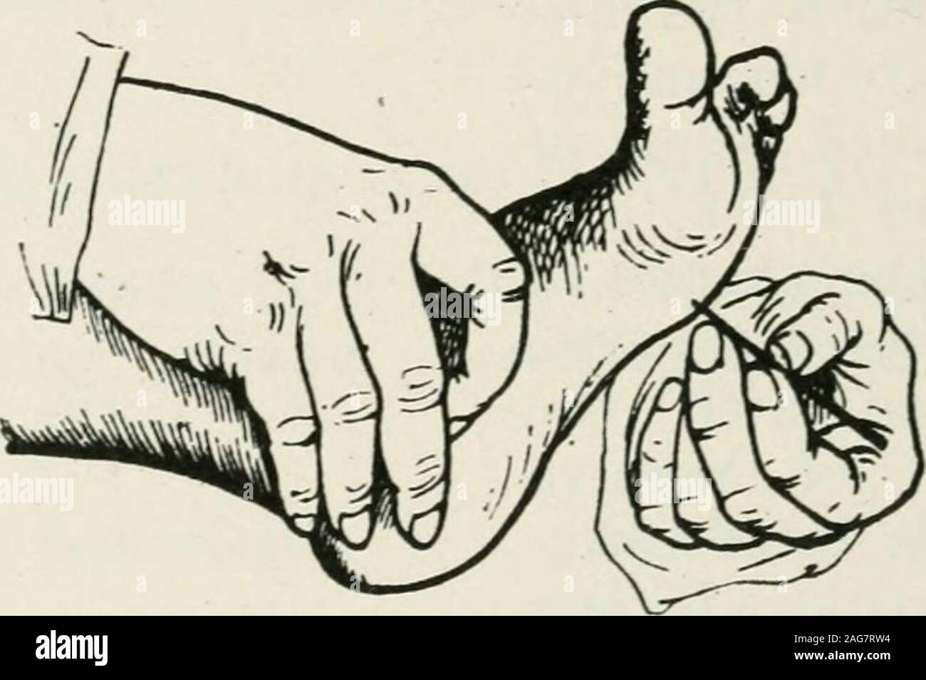 Babinski reflex hi-res stock photography and images - Alamy