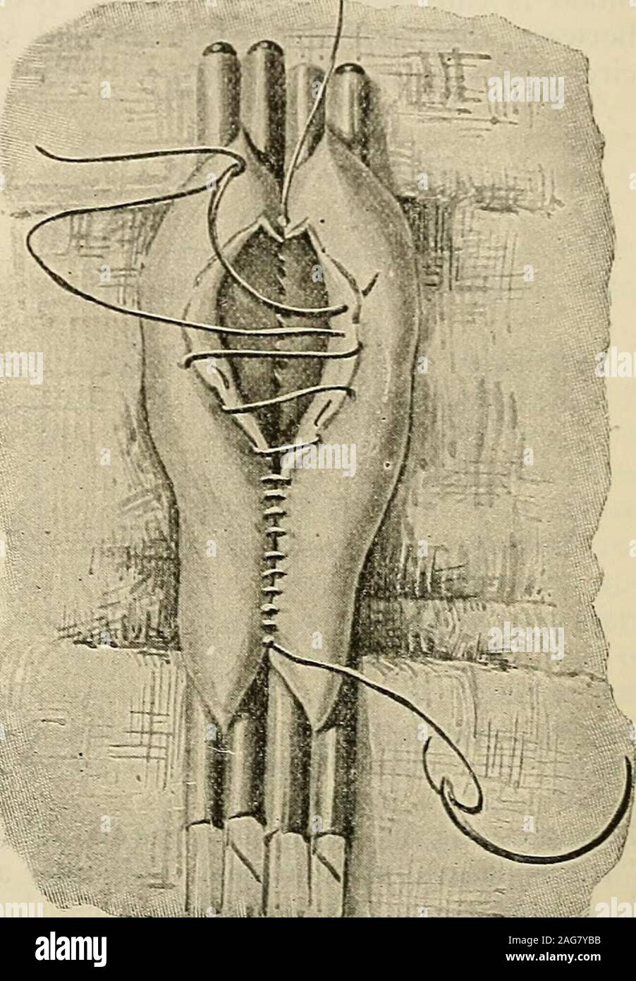 . Modern surgery, general and operative. ortion; and others with ...