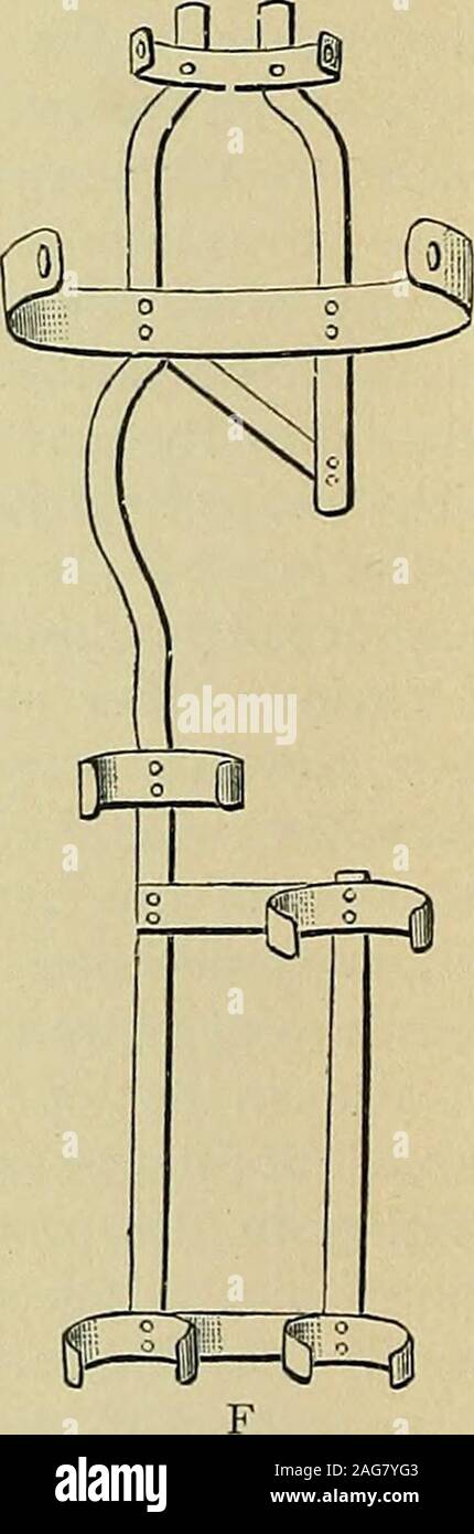 . The diseases of children : medical and surgical. Fig. 169.—Patterns ...
