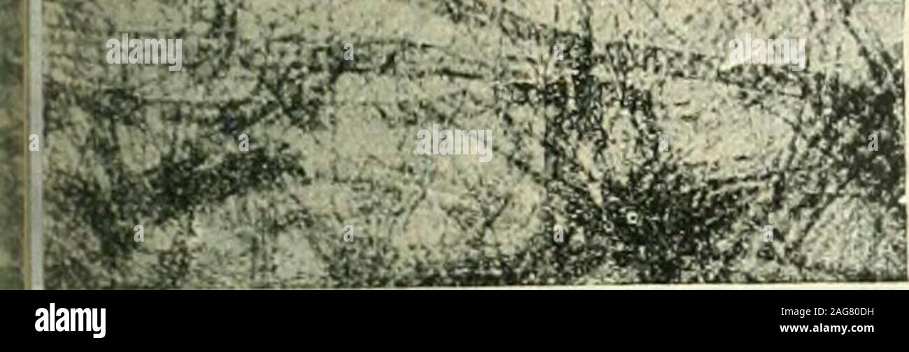 Stress fibres hi-res stock photography and images - Alamy