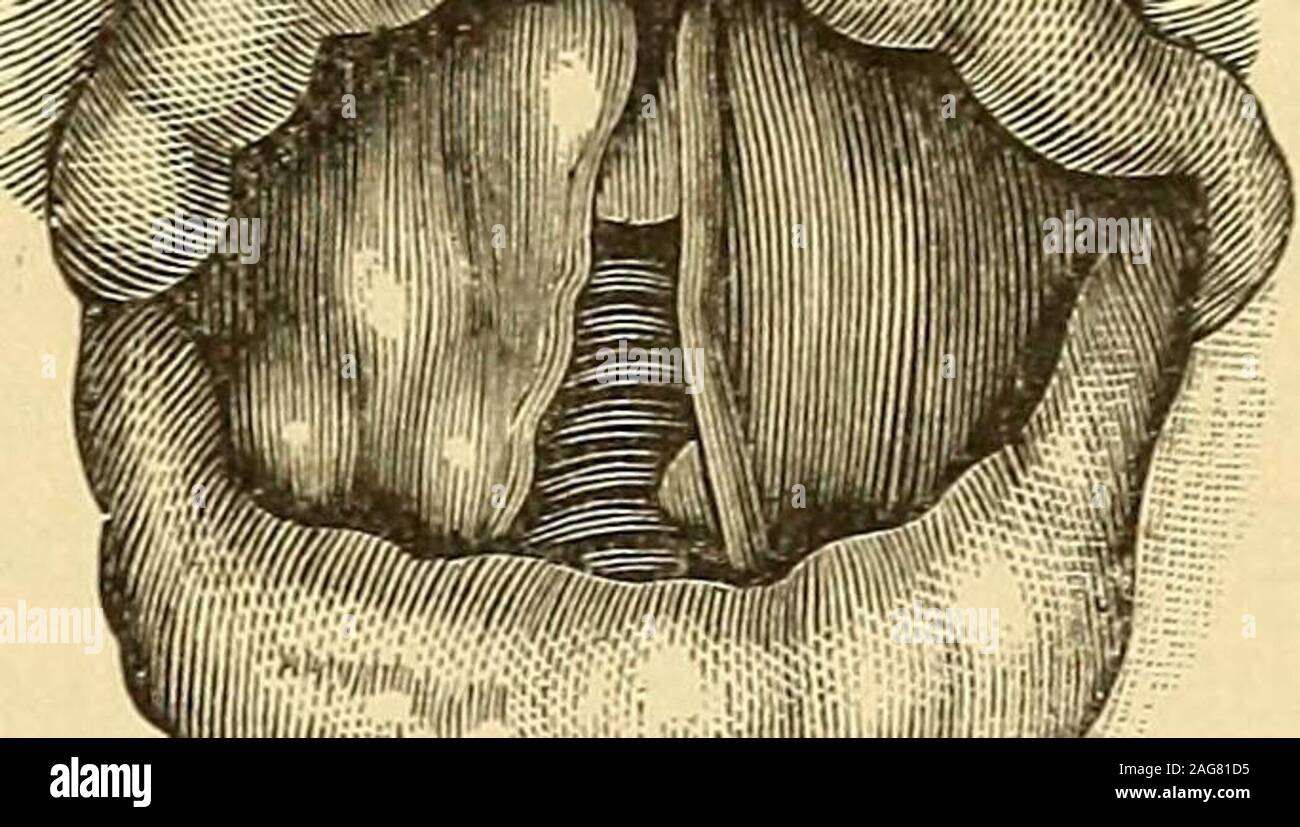 Onychia hi-res stock photography and images - Alamy