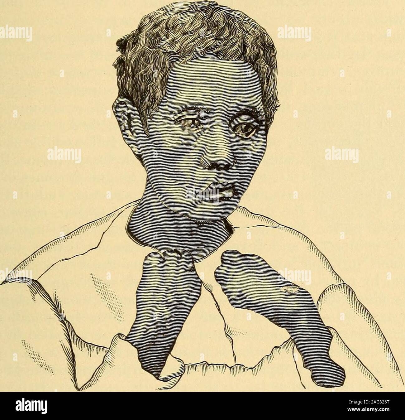 . A practical treatise on diseases of the skin, for the use of students ...