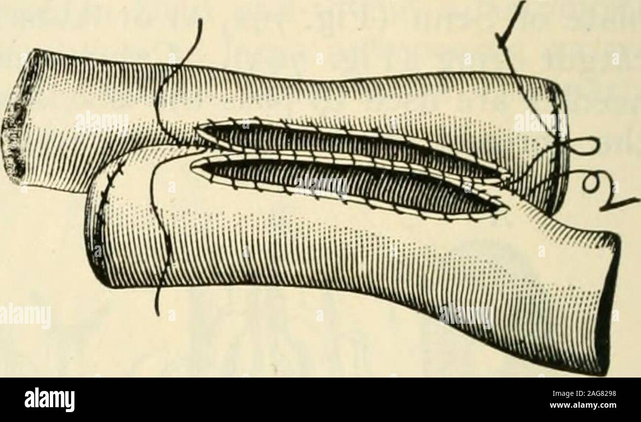 Horsley d hi-res stock photography and images - Alamy