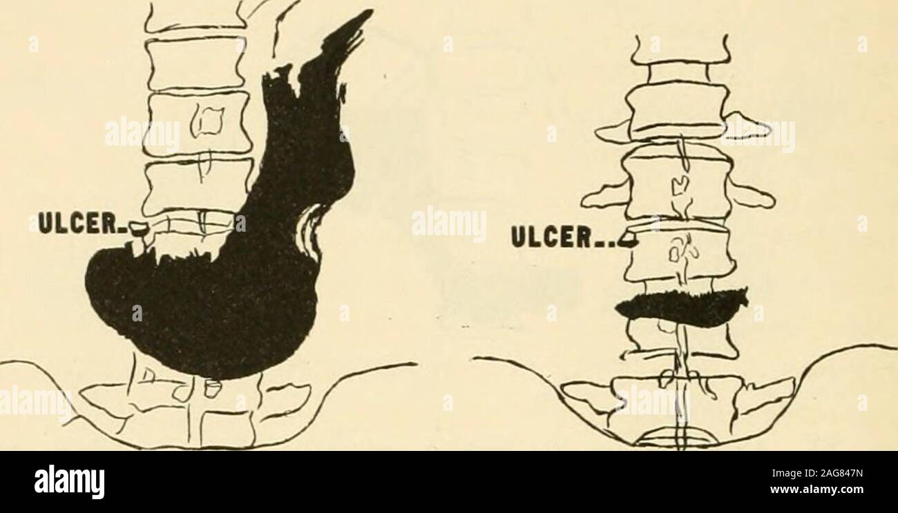 Fig xlii hi-res stock photography and images - Alamy