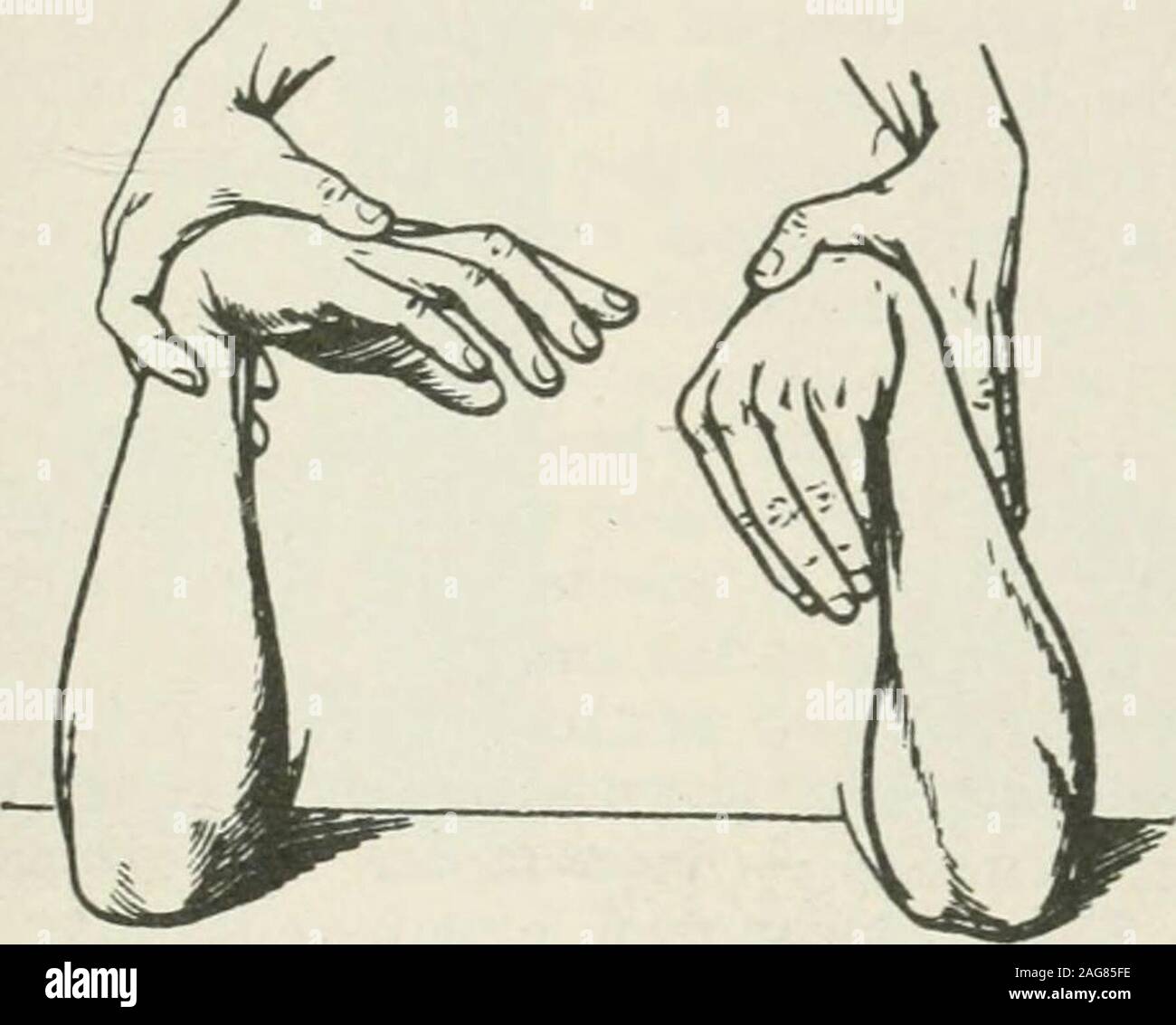 . Medical and surgical therapy. hehand is associated with paresis of ...
