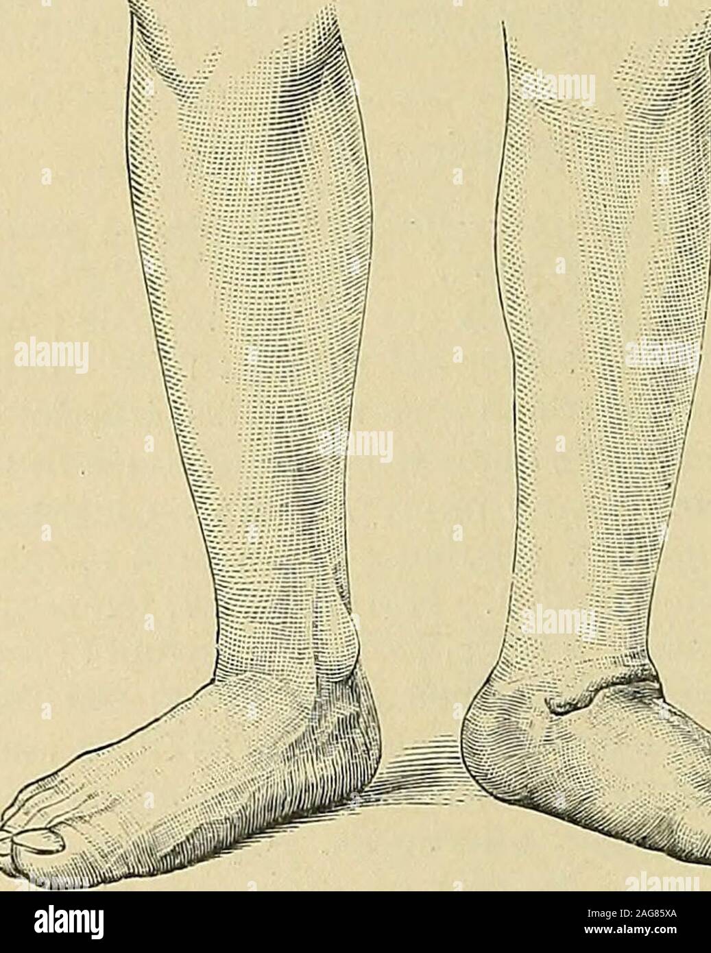 . The diseases of children : medical and surgical. ed. In such cases ...