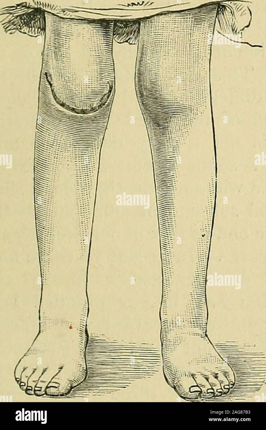 Erasion hi-res stock photography and images - Alamy