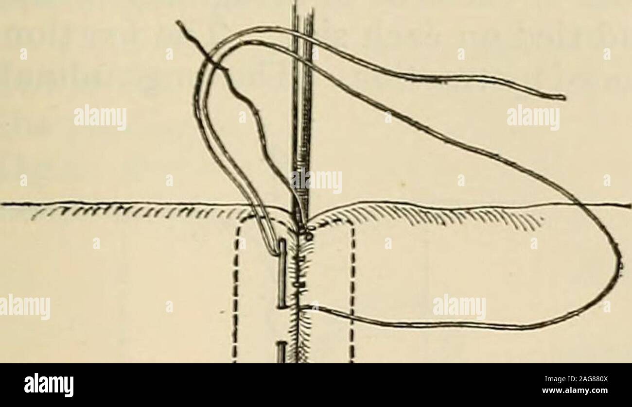 Harrington body hi-res stock photography and images - Alamy