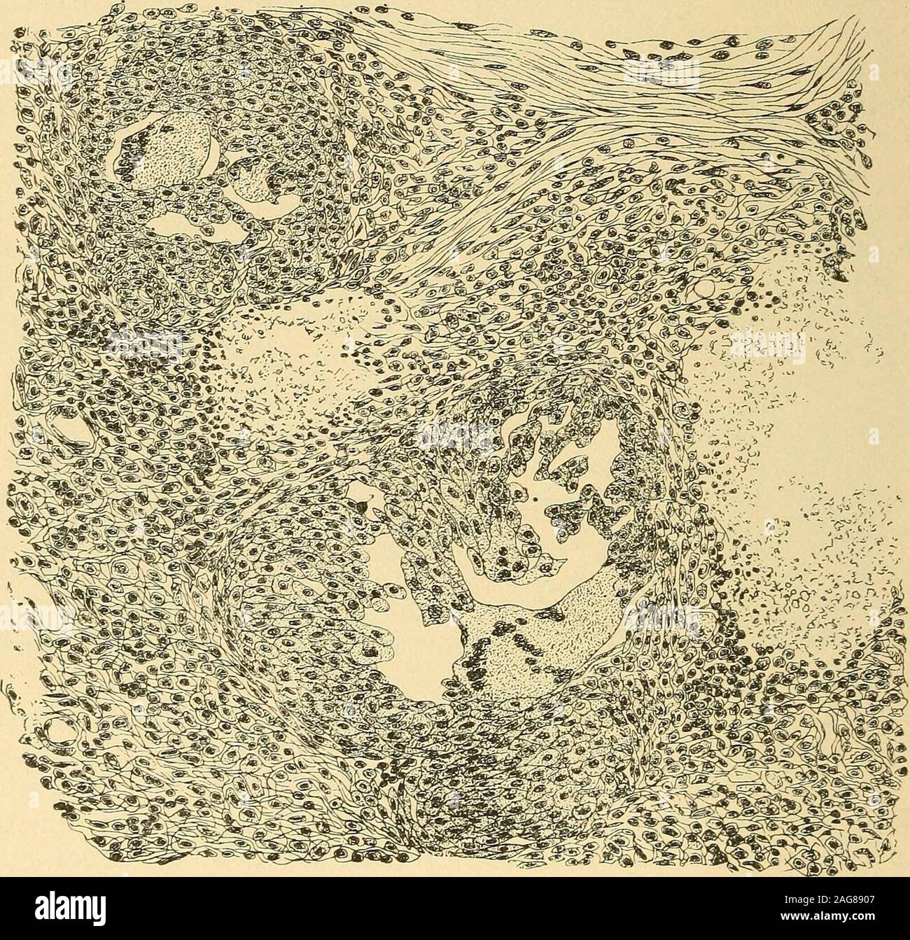 Scrofulous hi-res stock photography and images - Alamy