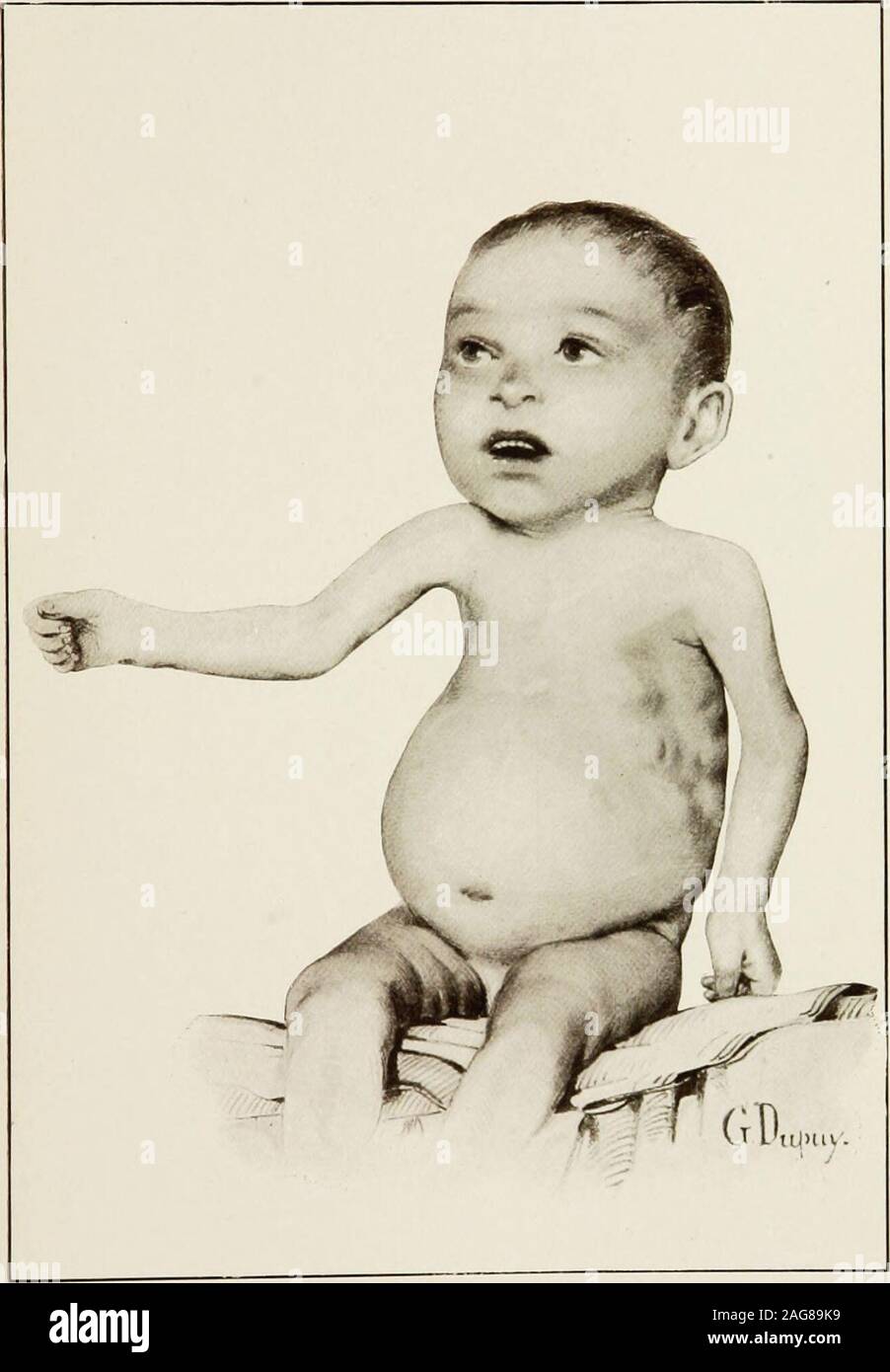 . The diseases of infancy and childhood : designed for the use of ...