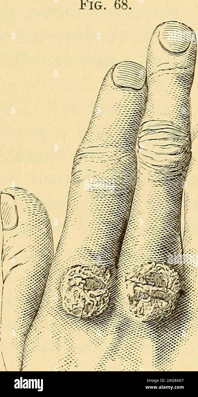 . A practical treatise on diseases of the skin, for the use of students ...