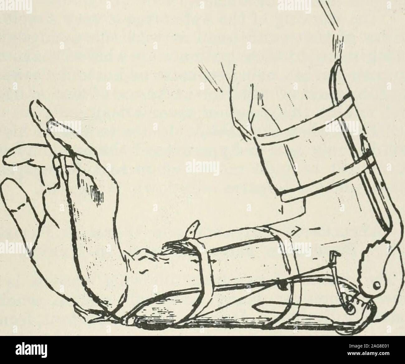 Extension And Flexion Of Arm