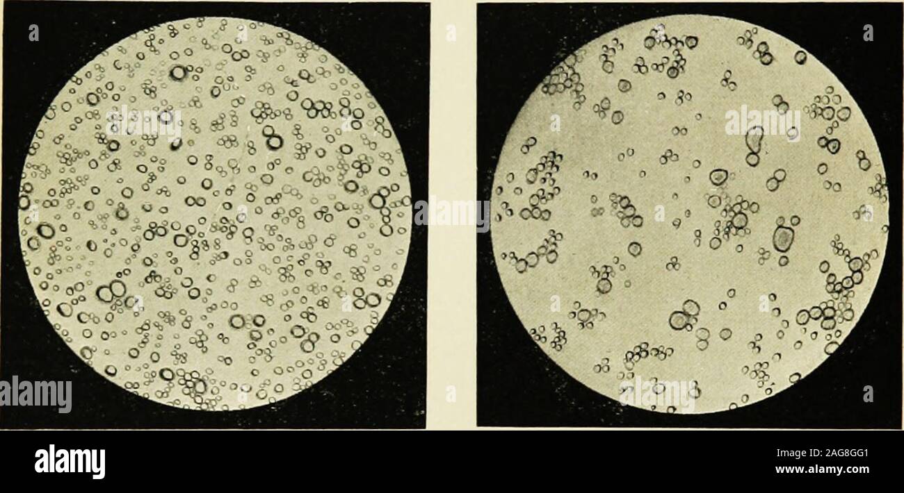 Fat globules hi-res stock photography and images - Alamy