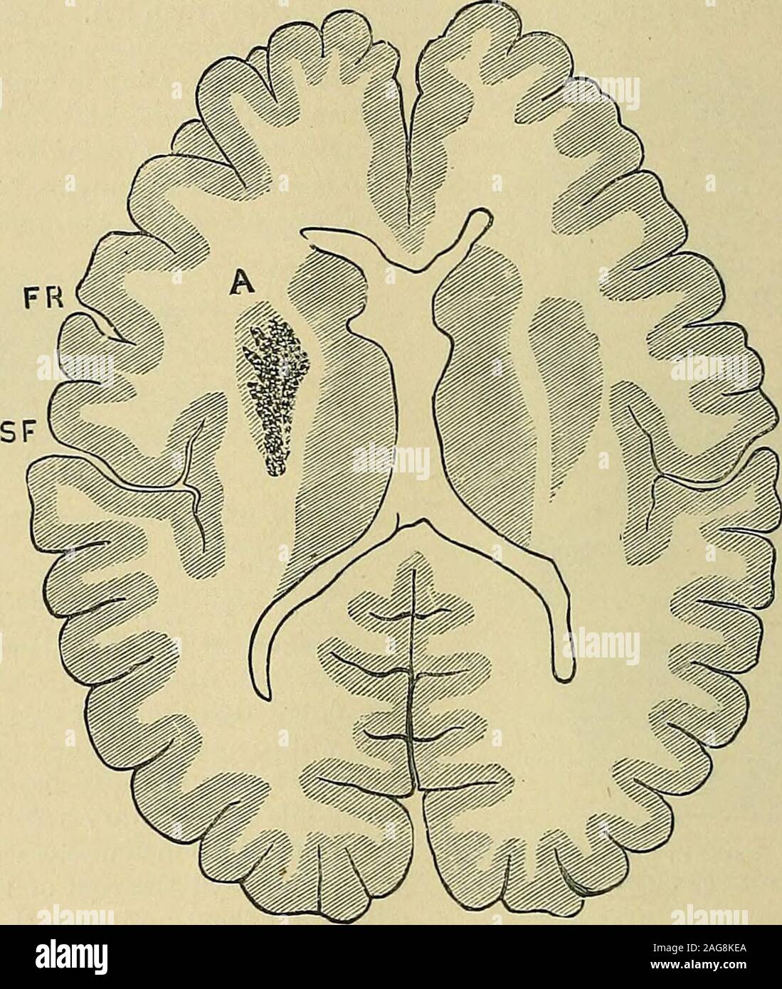 . The diseases of children : medical and surgical. ollowing morning ...