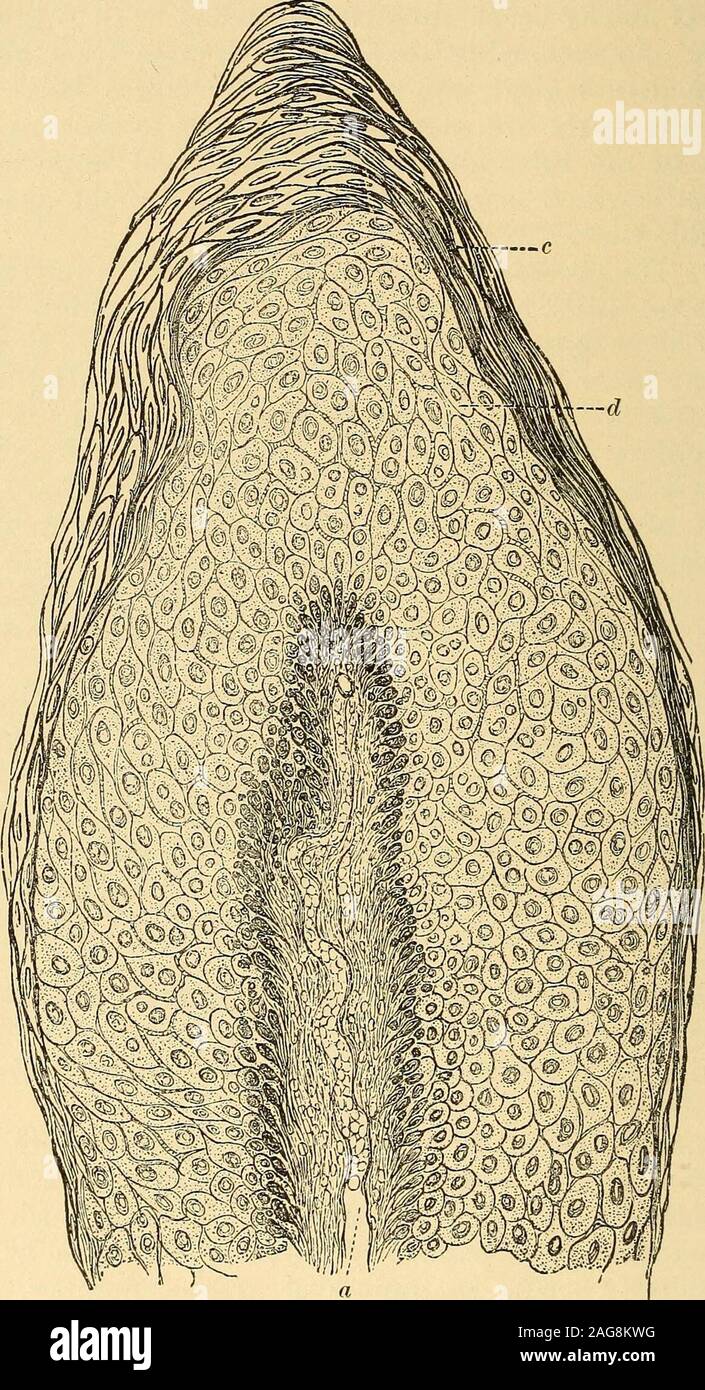 Palmar wart hi-res stock photography and images - Alamy