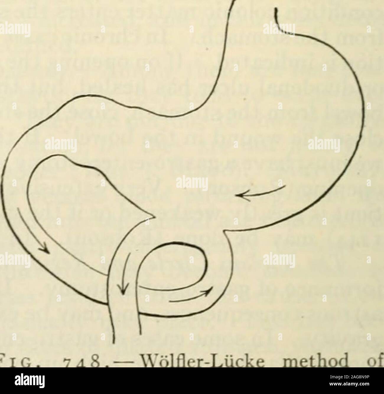 Gastro pass hi-res stock photography and images - Alamy