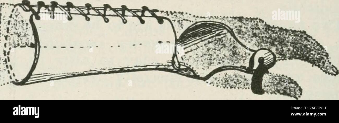 Tuffier hi-res stock photography and images - Alamy