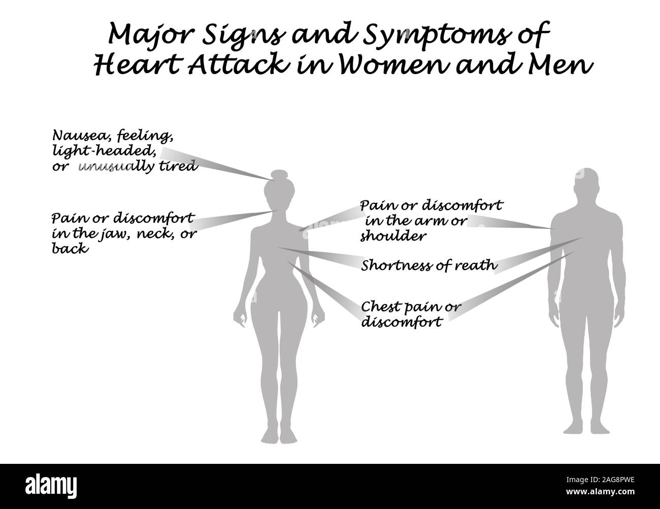 Major Signs and Symptom of Heart Attack Stock Photo - Alamy