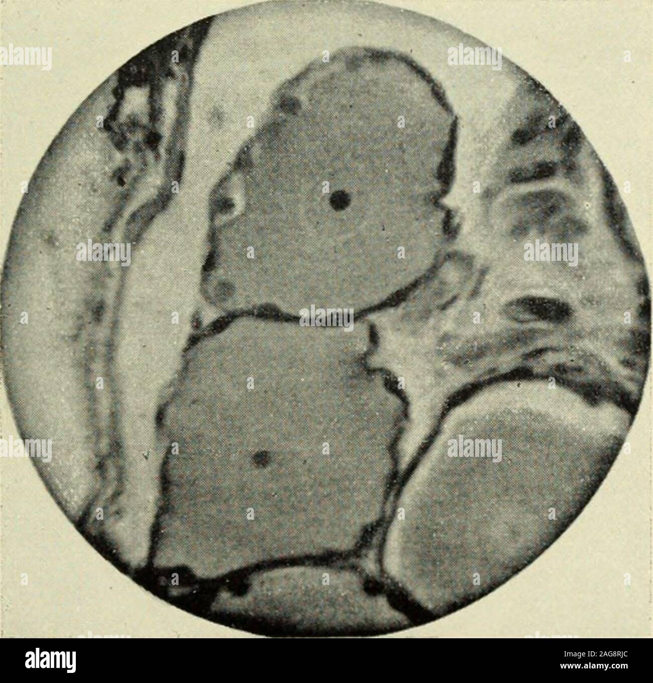 Spinal ganglion stimulation hi-res stock photography and images - Alamy