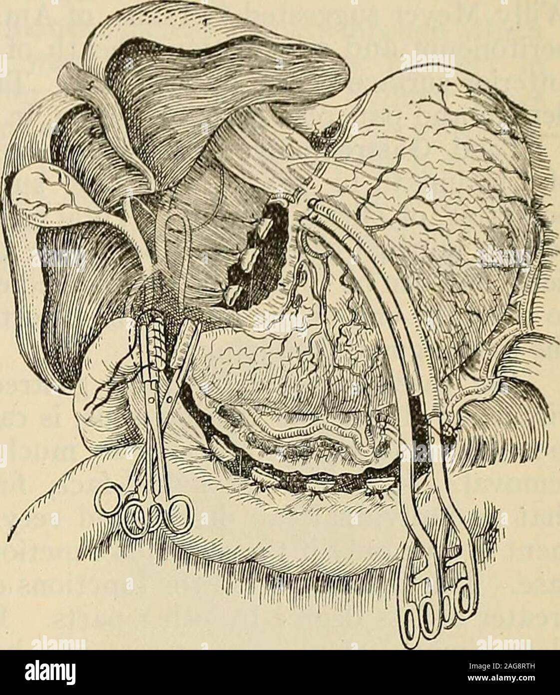 Transverse opening hi-res stock photography and images - Alamy