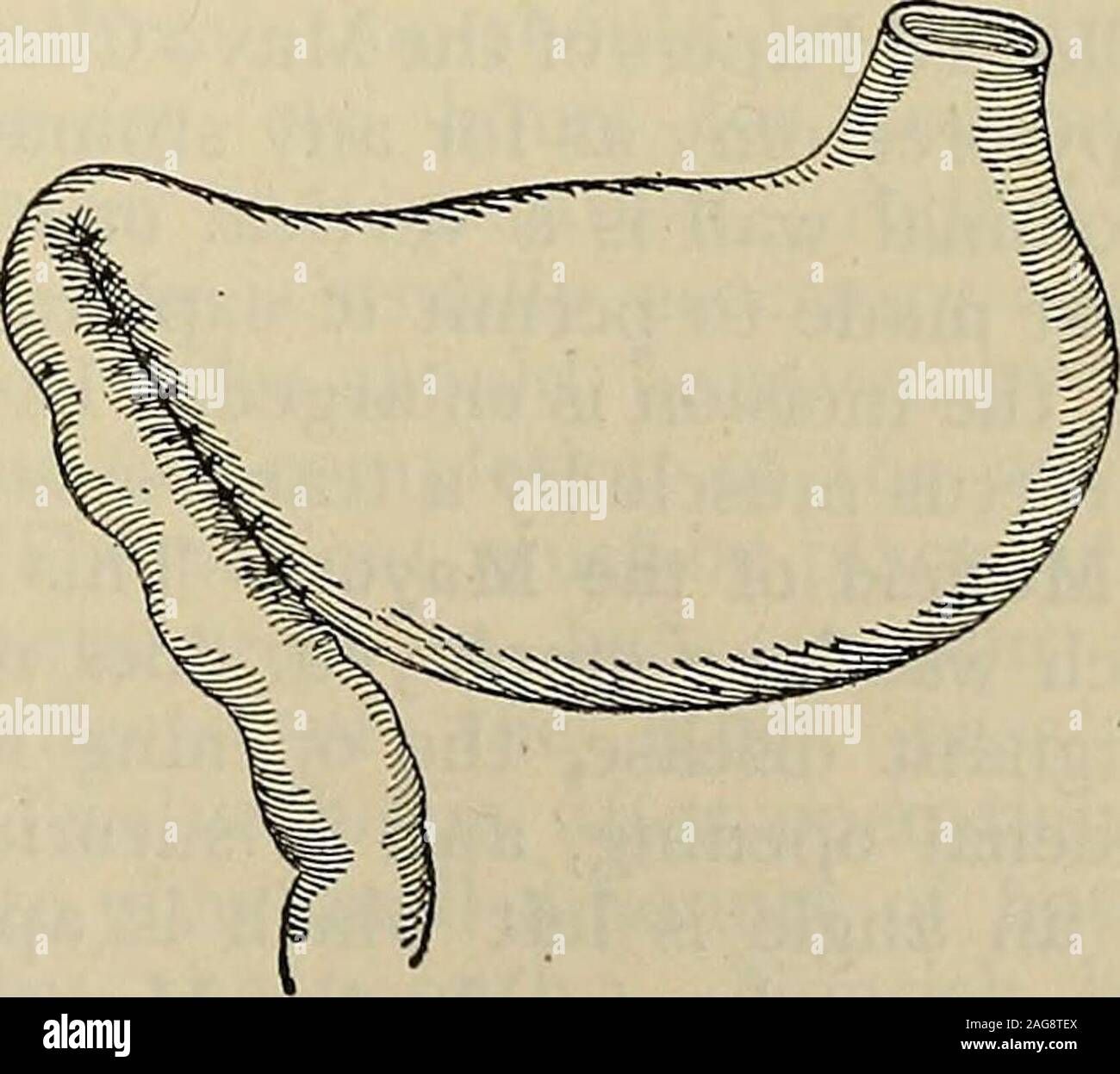 Sutures stomach hi-res stock photography and images - Alamy