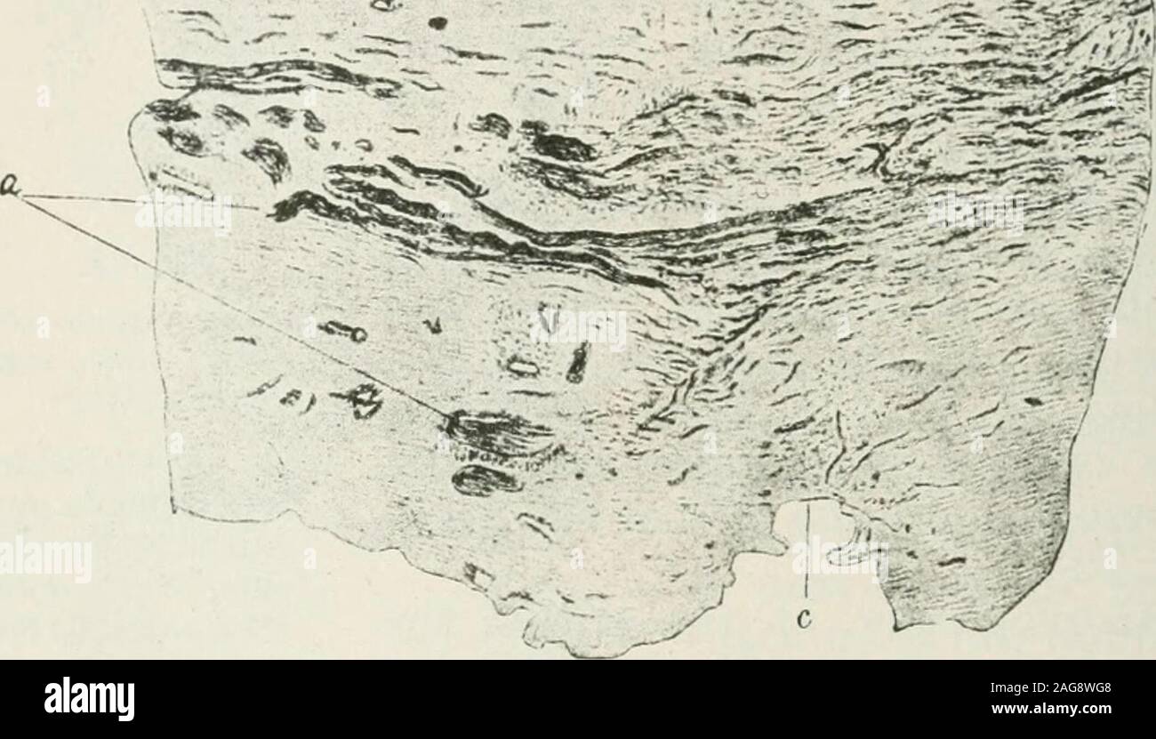 . Medical and surgical therapy. an intra- orjuxta-nervous character, i ...