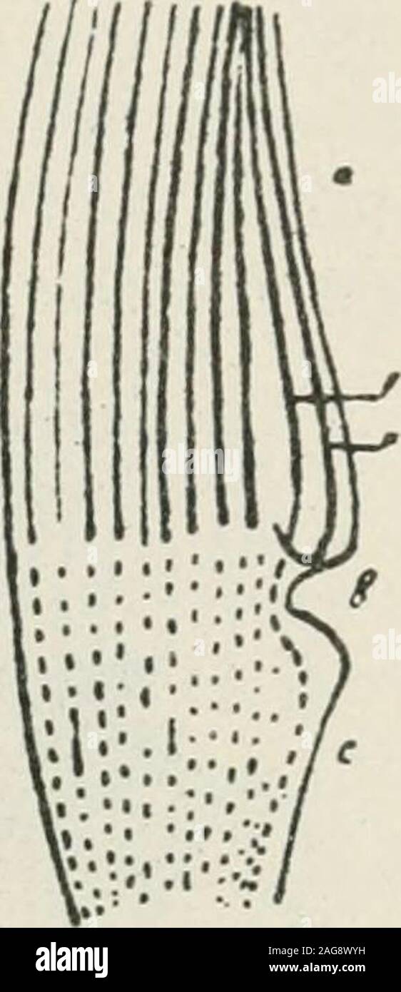 . Medical and surgical therapy. 2. That the intervening bridge is too ...