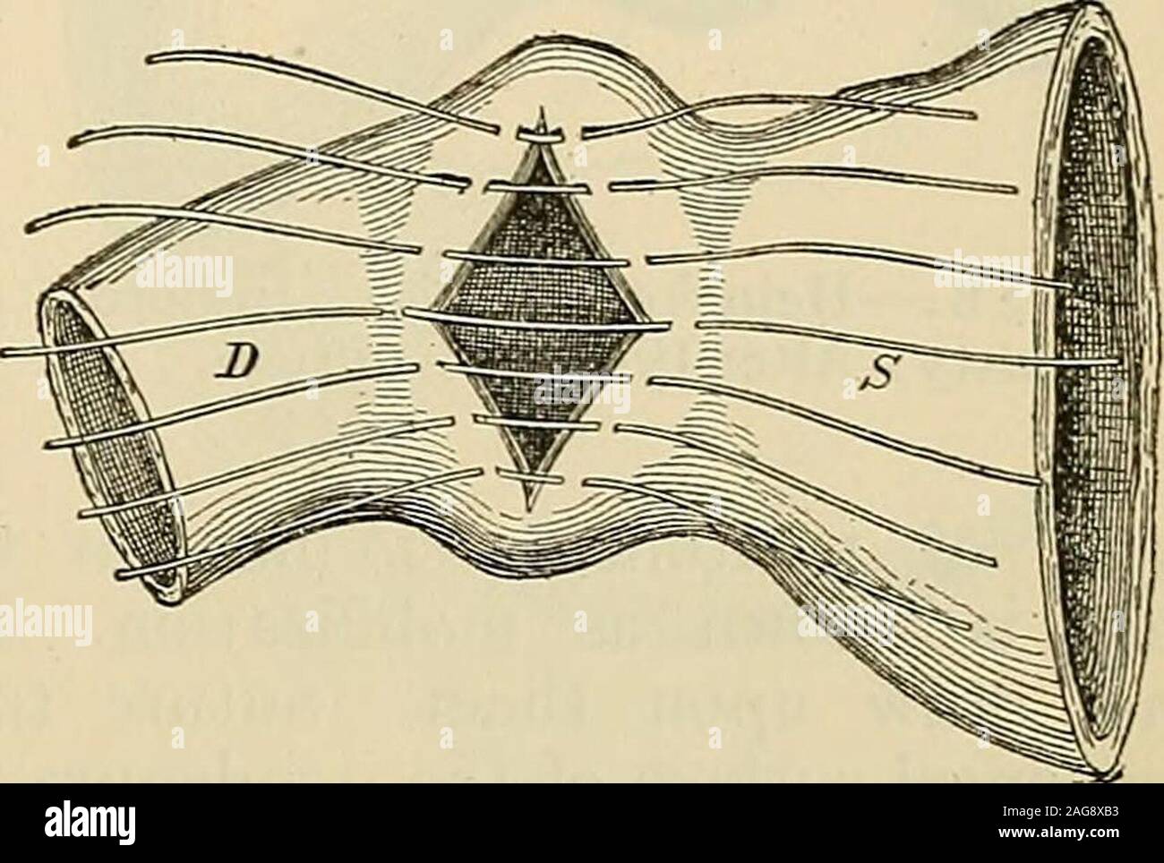 . Modern surgery, general and operative. Fig. 2 6 .—Heineke ...