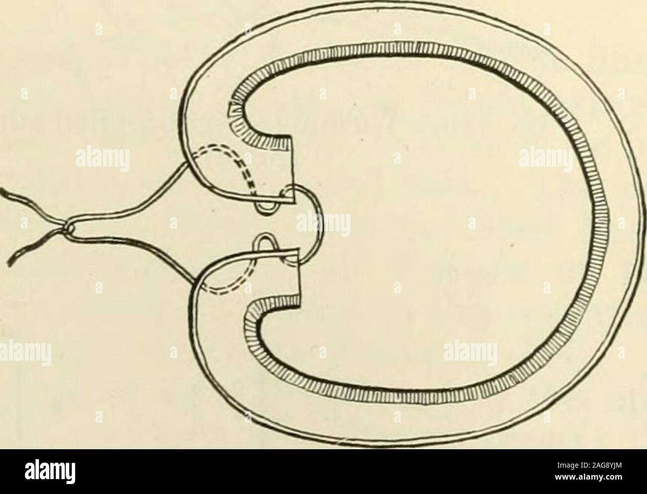 Omental hi-res stock photography and images - Alamy