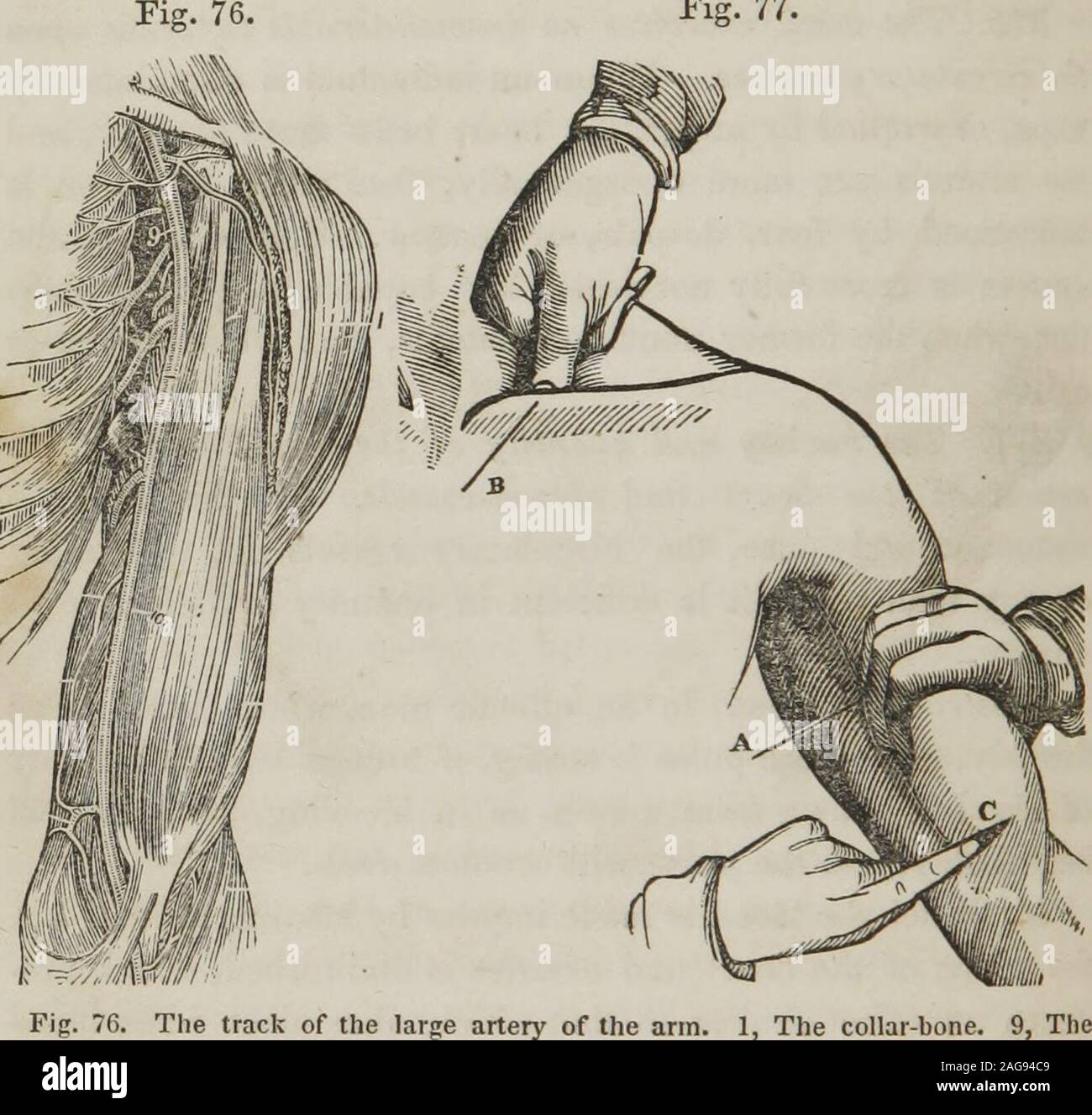 Vitiated air hi-res stock photography and images - Alamy