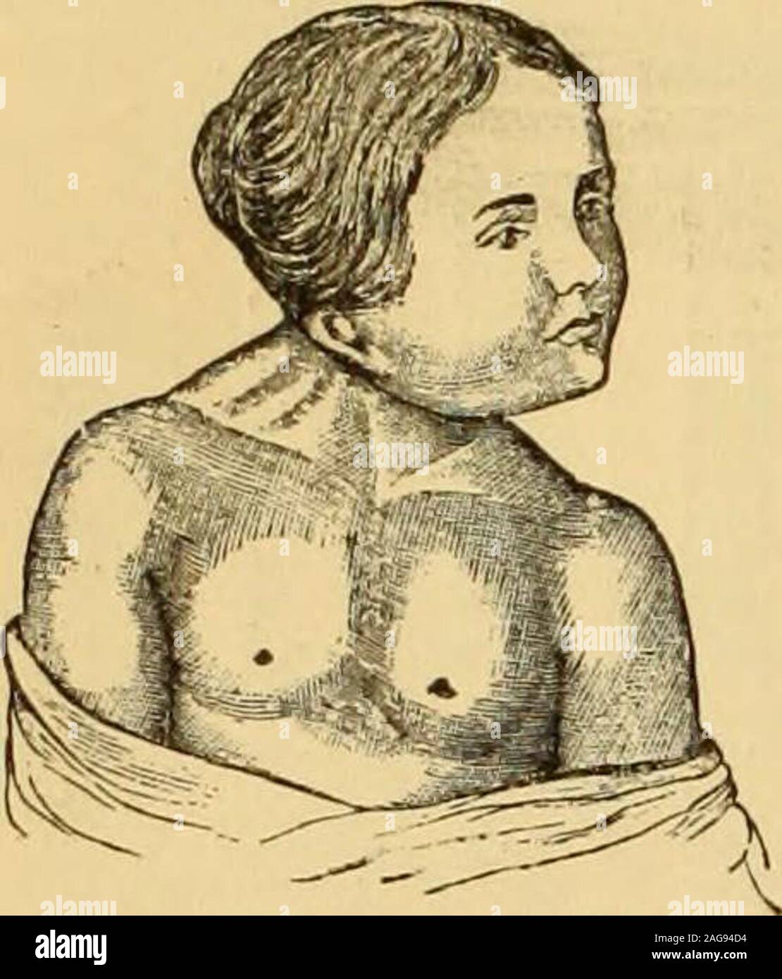 Chin cord hi-res stock photography and images - Alamy