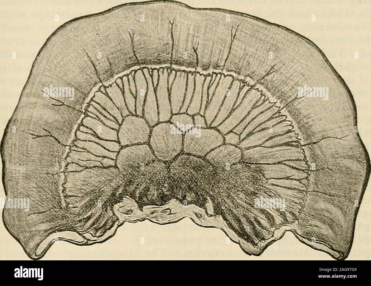 . Modern surgery, general and operative. Fig. 685.—A loop of intestine ...