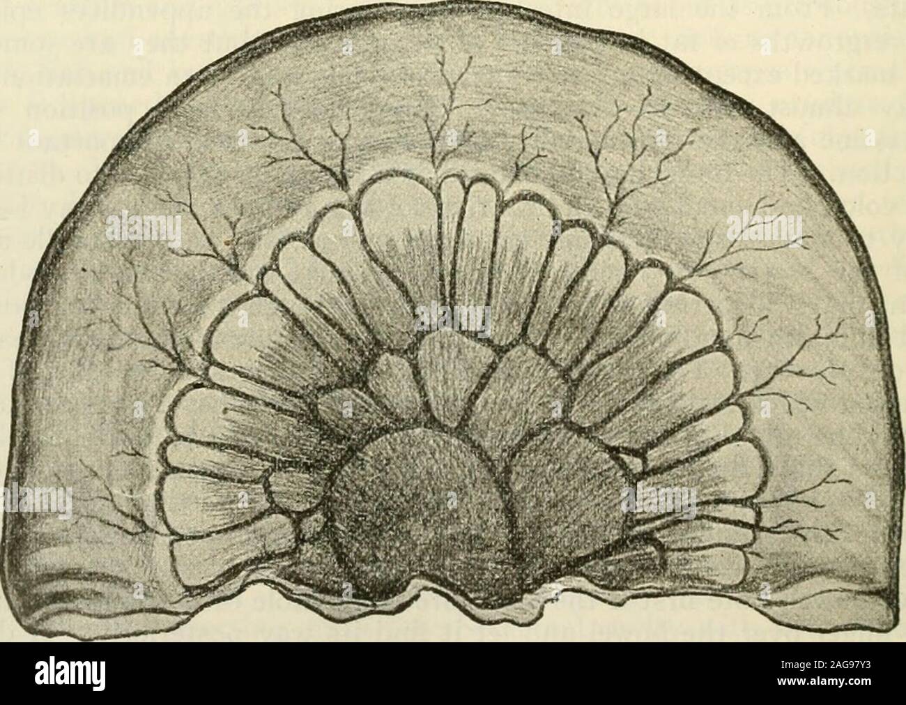 . Modern surgery, general and operative. Fig. 684.—A loop of intestine ...