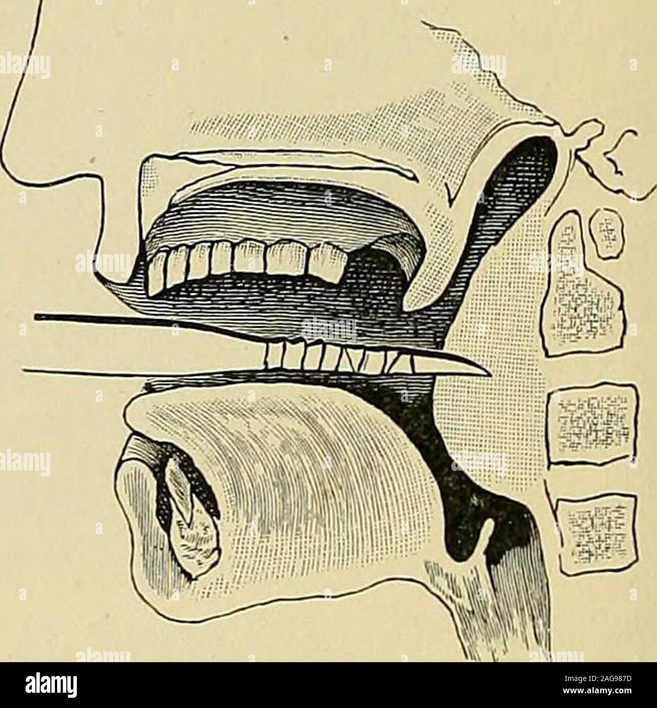 . Operative surgery. oint, with adhesive plaster, is then(Fig. 893 ...