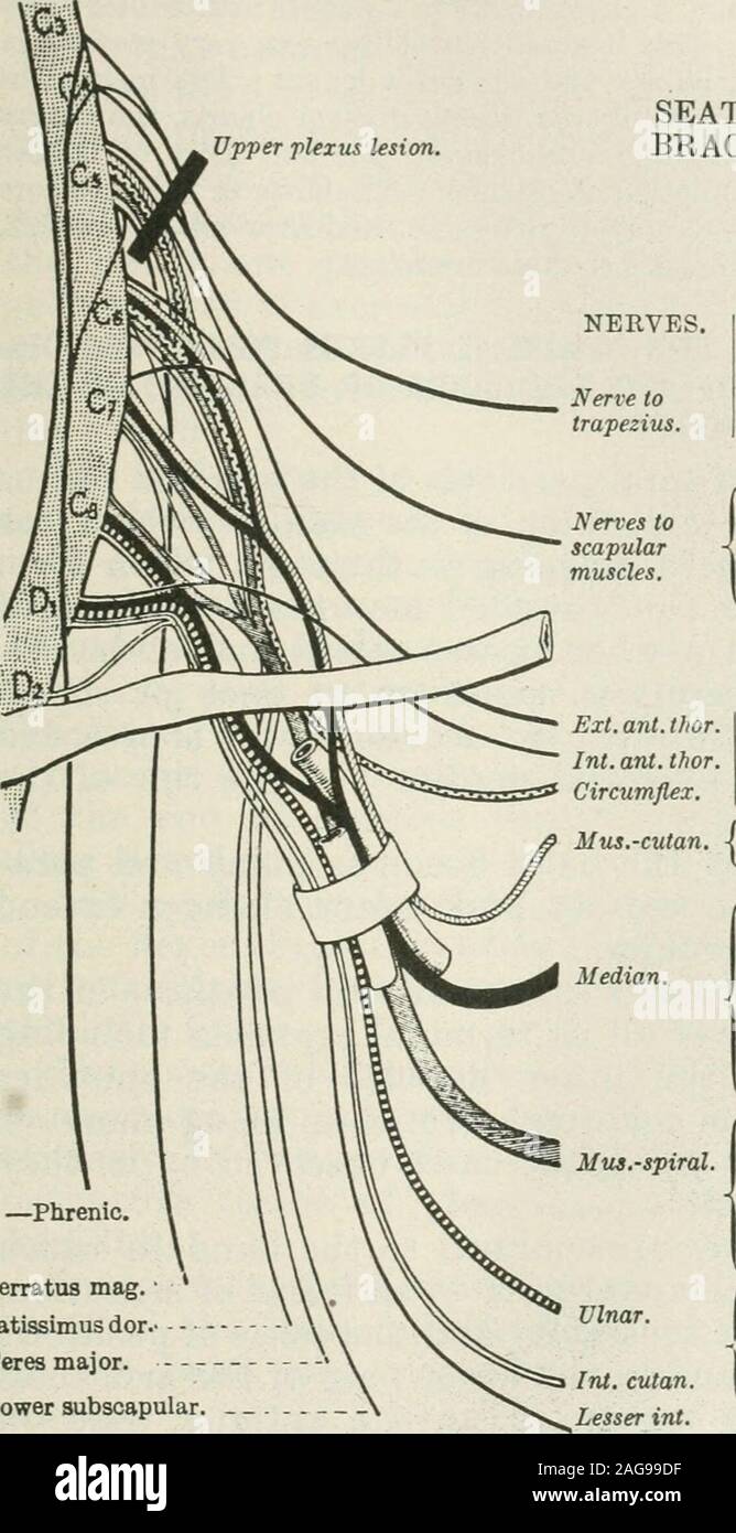 . Medical and surgical therapy. t of exit, four fingersbreadths from ...