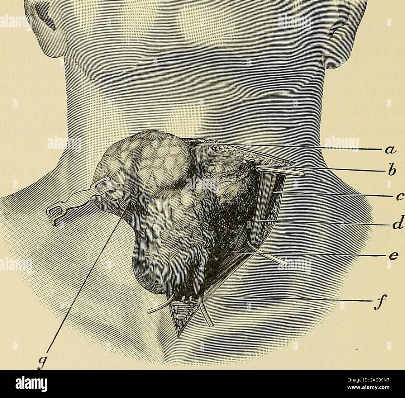 . Operative surgery. on(Fig. 886), Kochers method, a. Superior thyroid ...