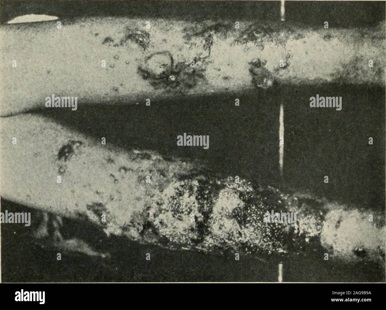 Erythematous hi-res stock photography and images - Alamy