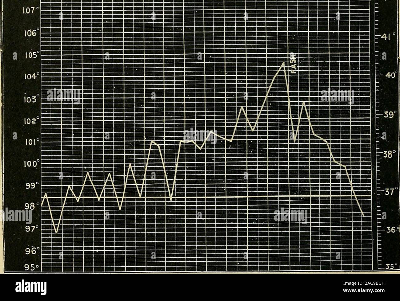 Swollen brain hi-res stock photography and images - Alamy