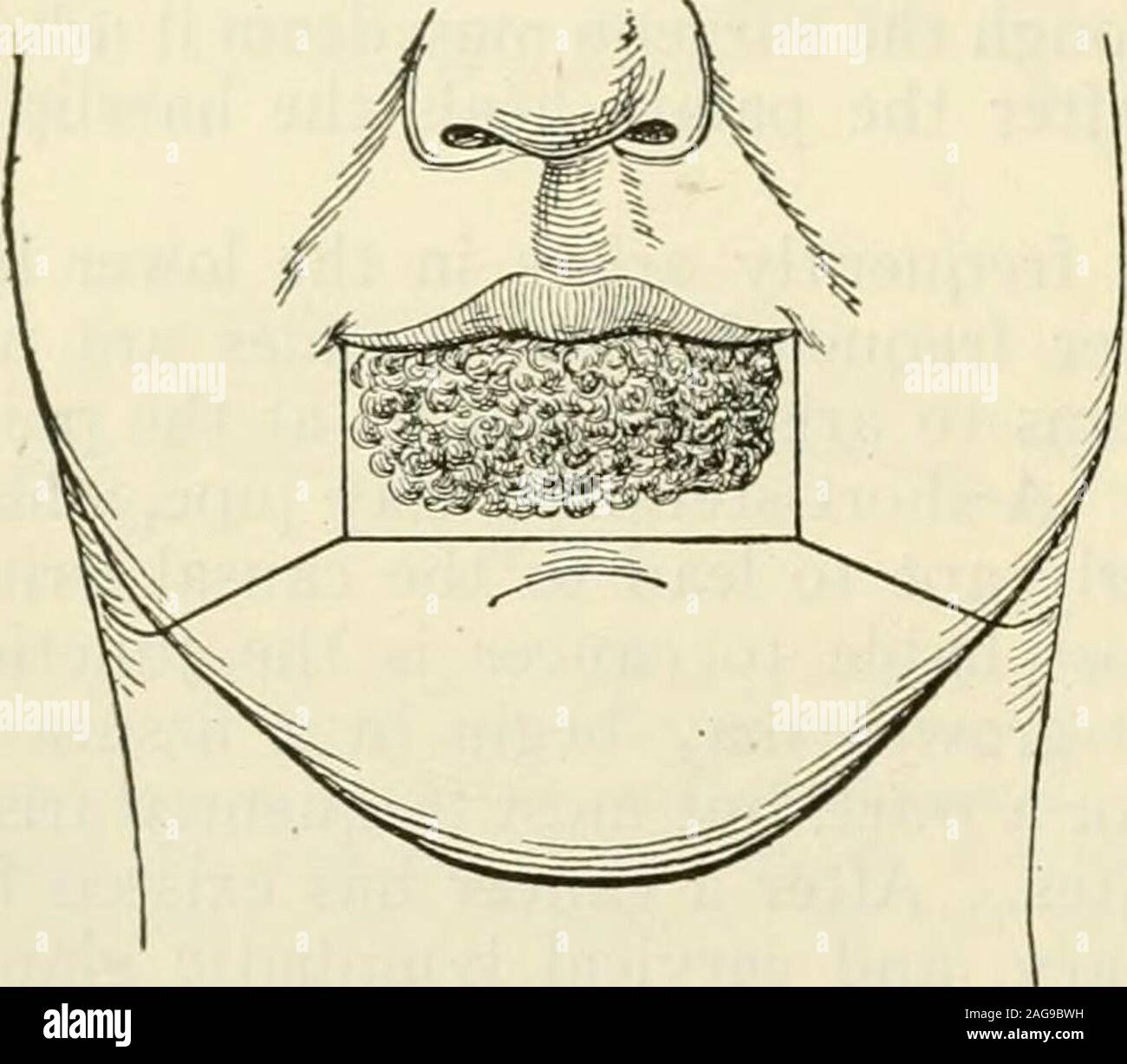 . Modern surgery, general and operative. surfaceof the body of the jaw ...