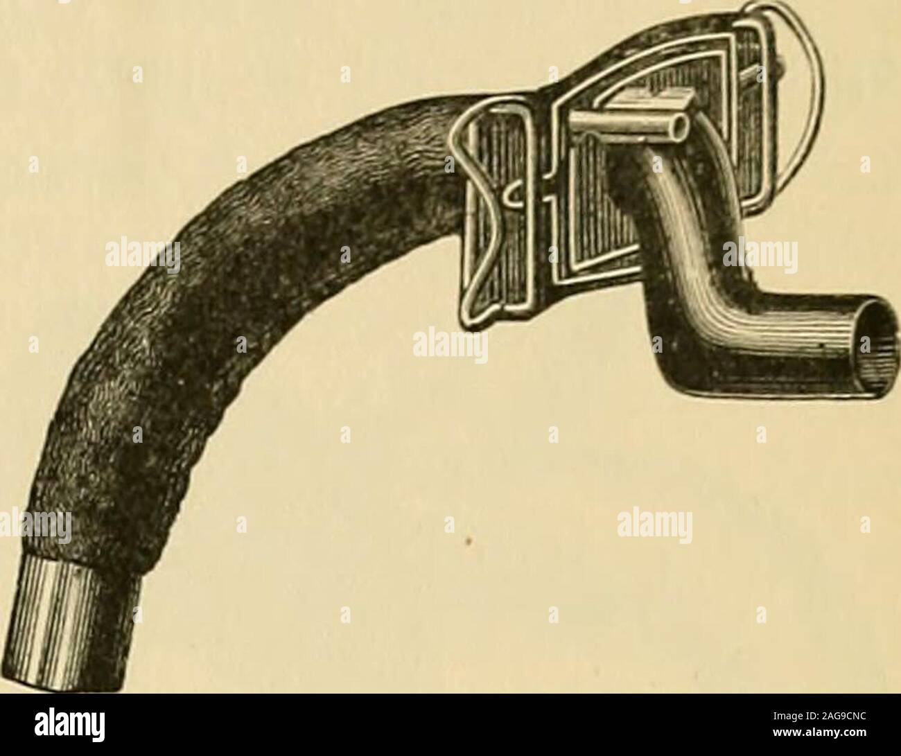 . Operative surgery. Fig. 877.—Trendelenburgs tam-pon, a, b. Tube for ...