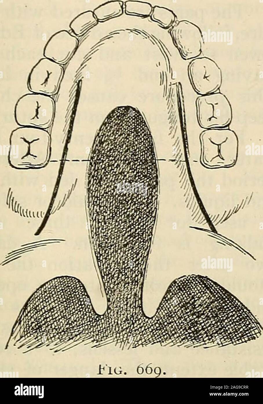 Postpon hi-res stock photography and images - Alamy