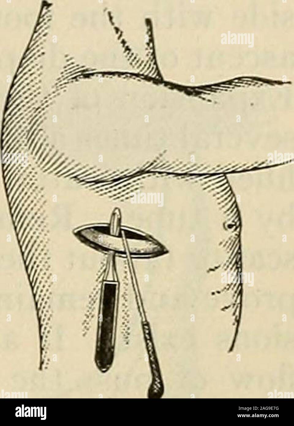 Seventh rib hi-res stock photography and images - Alamy