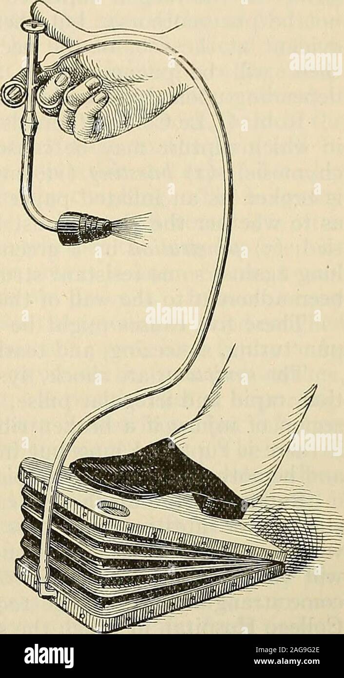 . Modern surgery, general and operative. ut suture. The apparatusfor ...