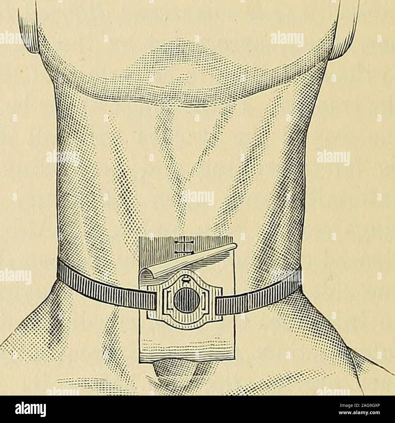 . Operative surgery. videdexactly in the median line from above ...