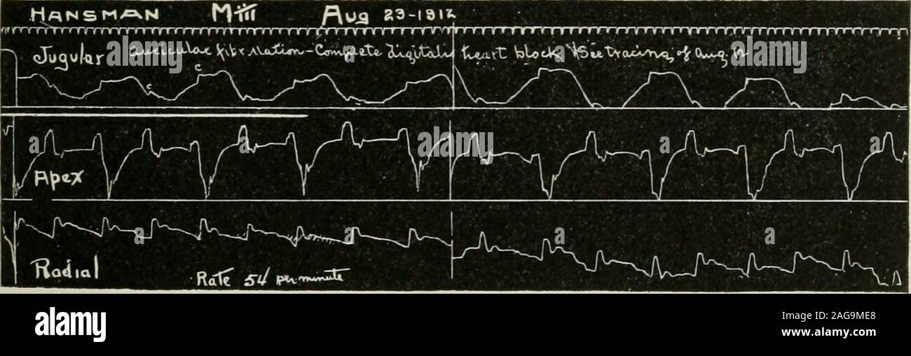 Uprightposition hi-res stock photography and images - Alamy