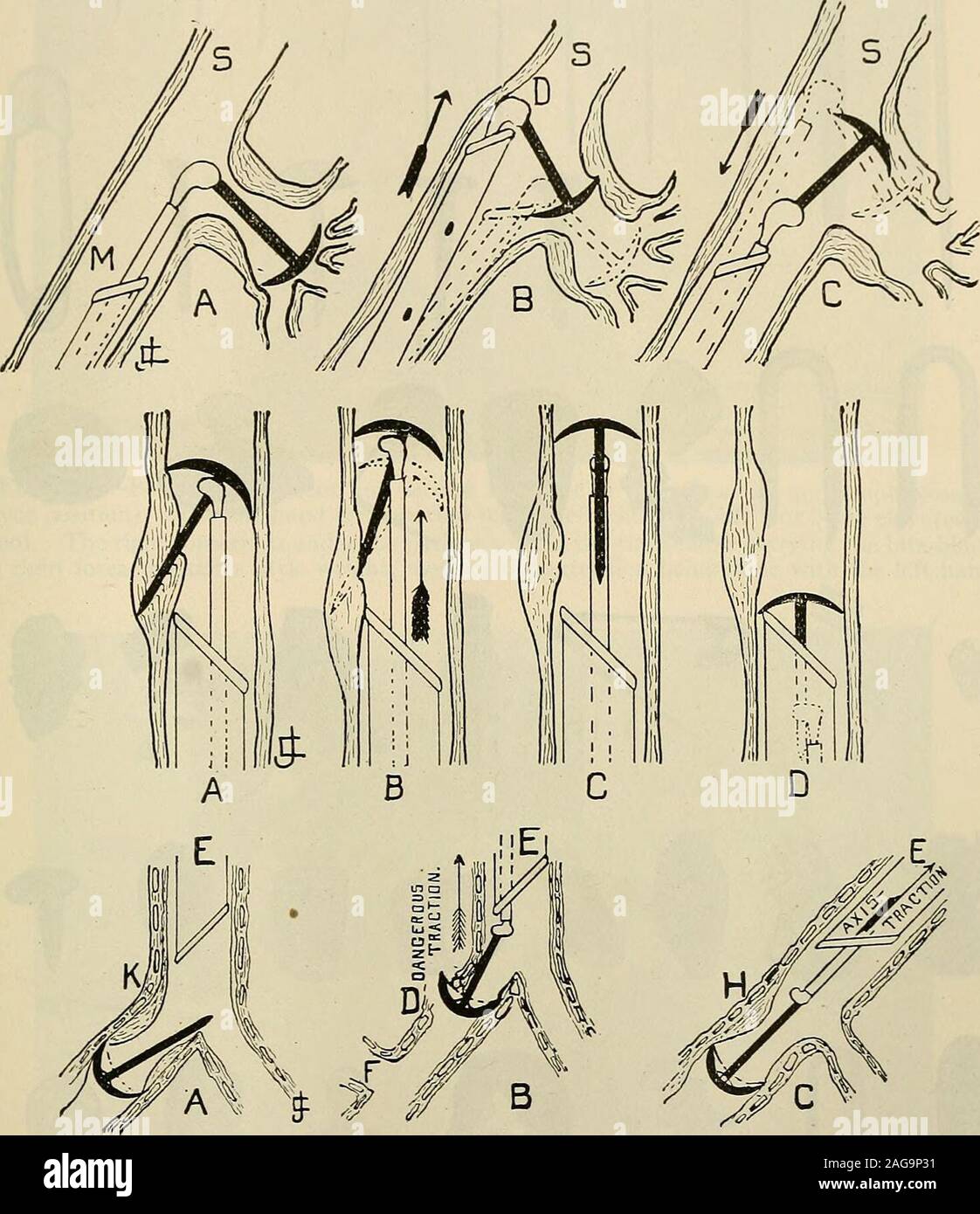 Trailing beans hi-res stock photography and images - Alamy