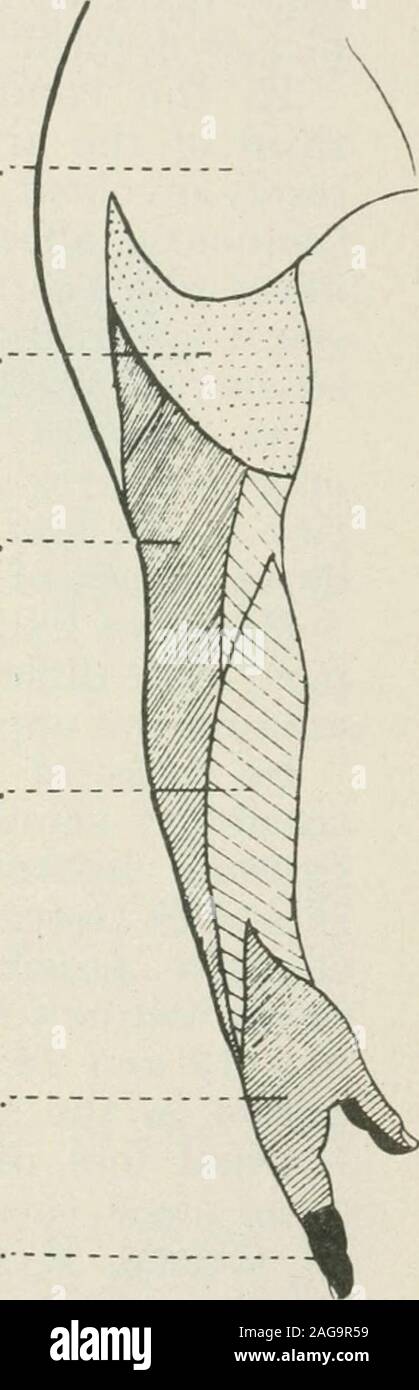 . Medical and surgical therapy. Musculo-cutaneous. -- Internal ...