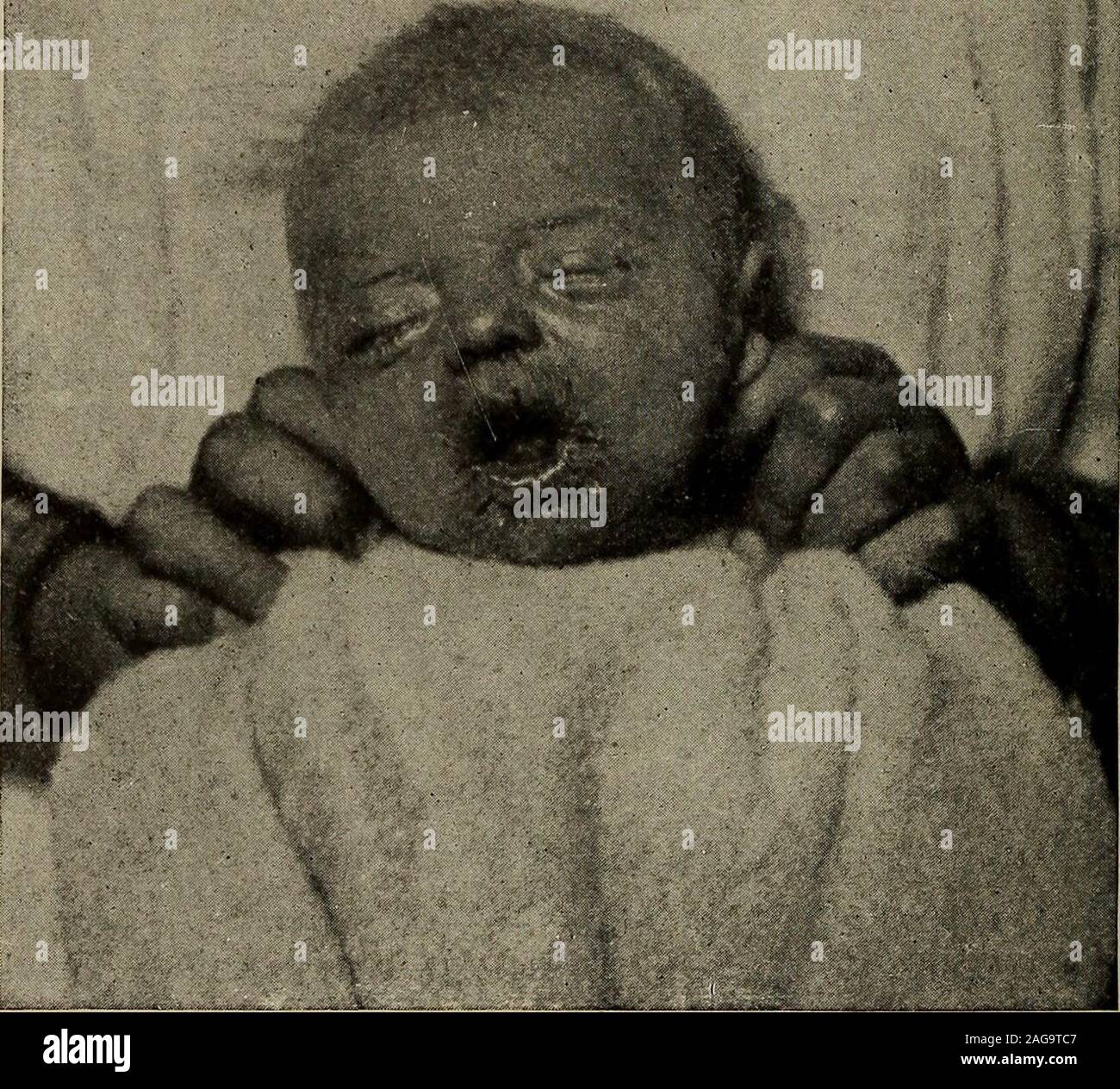 . Diseases of children. in all stages, but especially inthe second ...