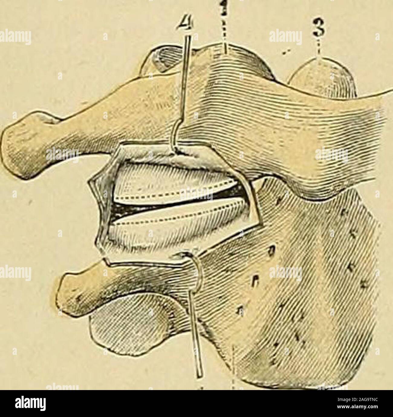 Anatomie de la capsule hi-res stock photography and images - Alamy